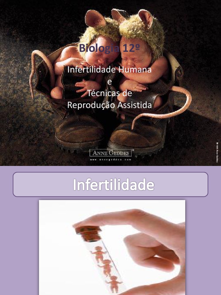 Infertilidade Humana e Tecnicas de Reproduçao Assistida | PDF ...