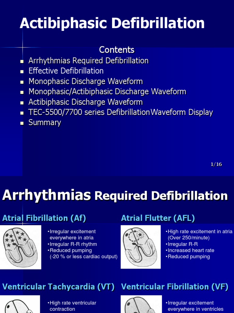 Biphasic Defbrillation | PDF | Cardiac Arrhythmia | Atrium (Heart)
