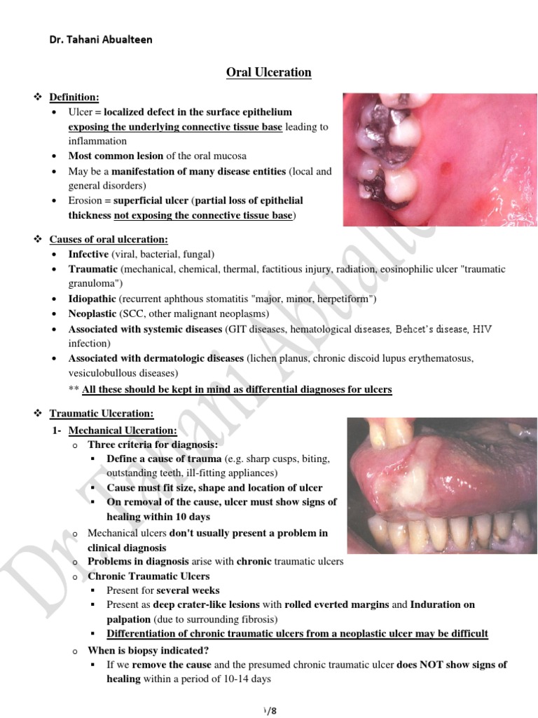 5 - Oral Ulceration | PDF | Diseases And Disorders | Medicine