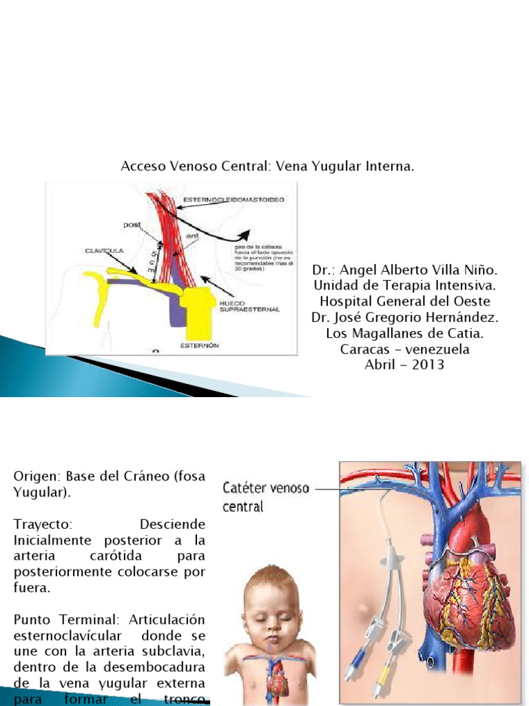 Acceso Venoso Central Vena Yugular Interna. | PDF | Arteria carótida ...