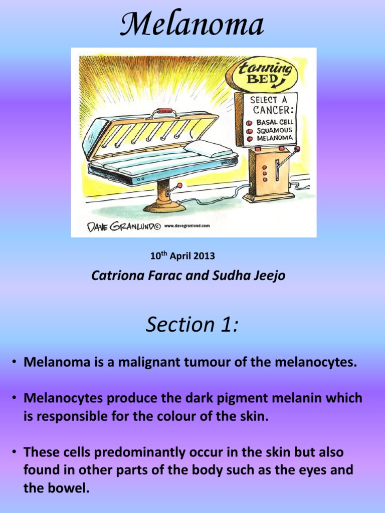 Melanoma Cancer Presentation | PDF | Melanoma | Metastasis