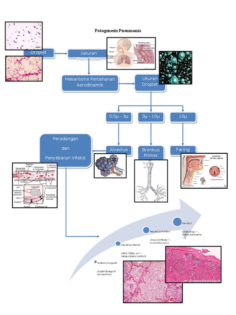 Patogenesis Pneumonia | PDF