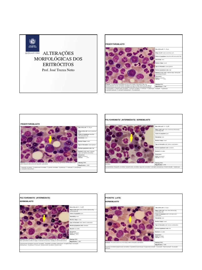 Aula 4 - Eritrocitos Morfologia | PDF | Red Blood Cell | Cell Nucleus