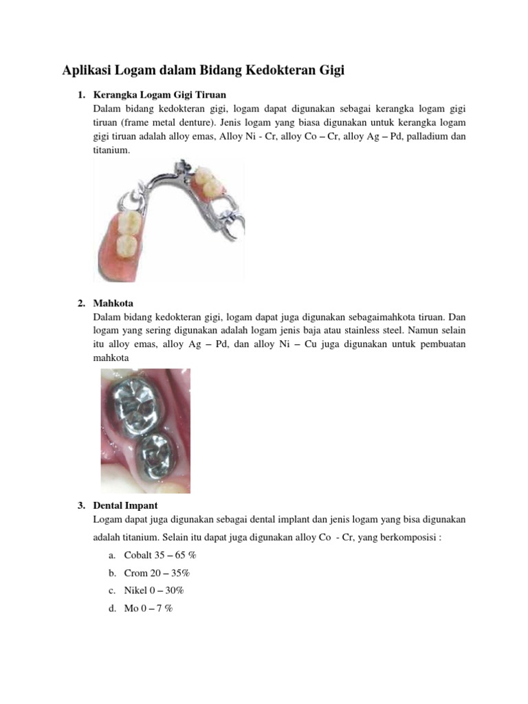 Aplikasi Logam dalam Kedokteran Gigi | PDF