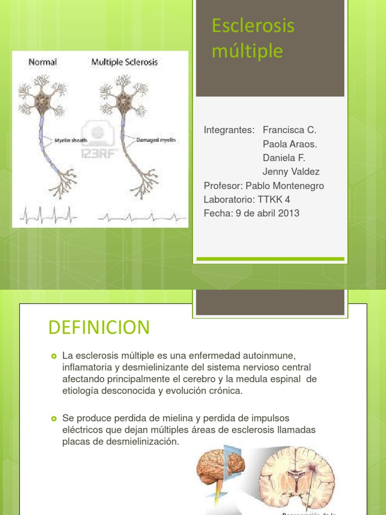 Esclerosis Multiple | Esclerosis múltiple | Mielina | Prueba gratuita ...