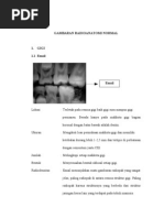 Interpretasi Hasil Foto Rontgen Anatomi Normal | PDF