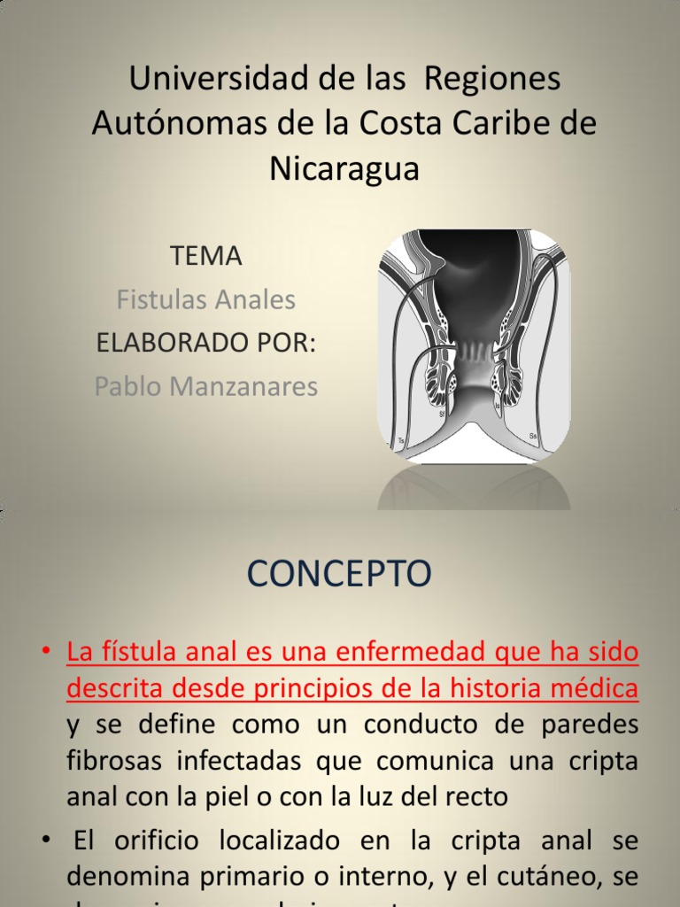 Fístulas Anales: Conceptos y Tratamientos | PDF | Hemorroides ...