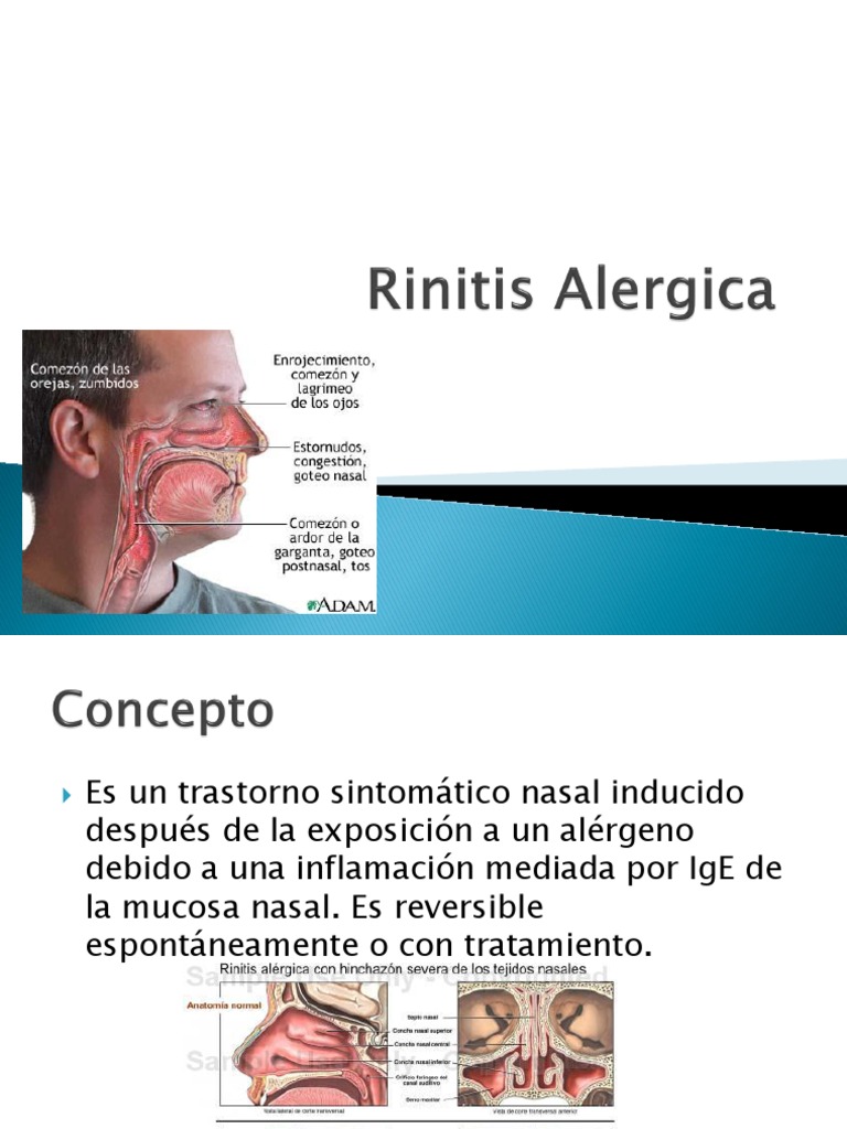 Guía de Rinitis Alérgica | PDF | Rtt | Enfermedades y trastornos