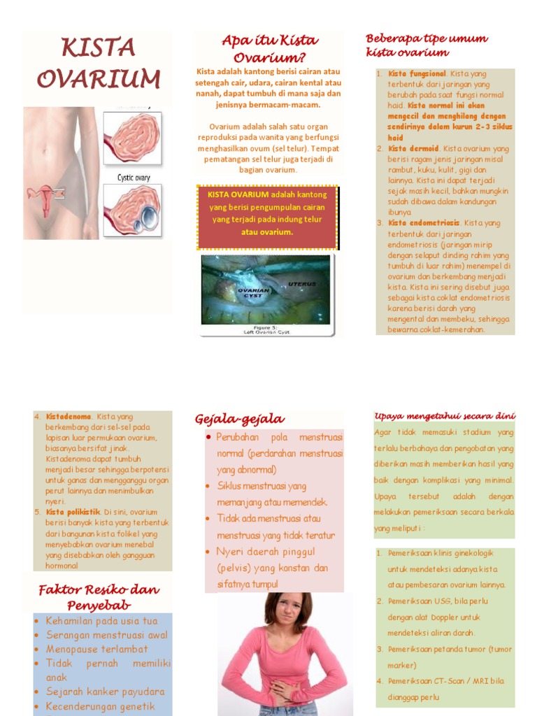 Leaflet Kista Ovari | PDF