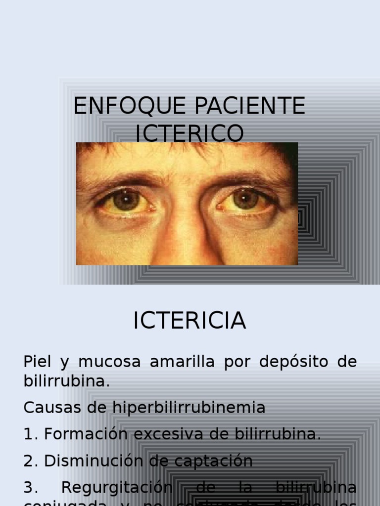 Enfoque Del Paciente Icterico | PDF | Hepatitis | Hepatitis B