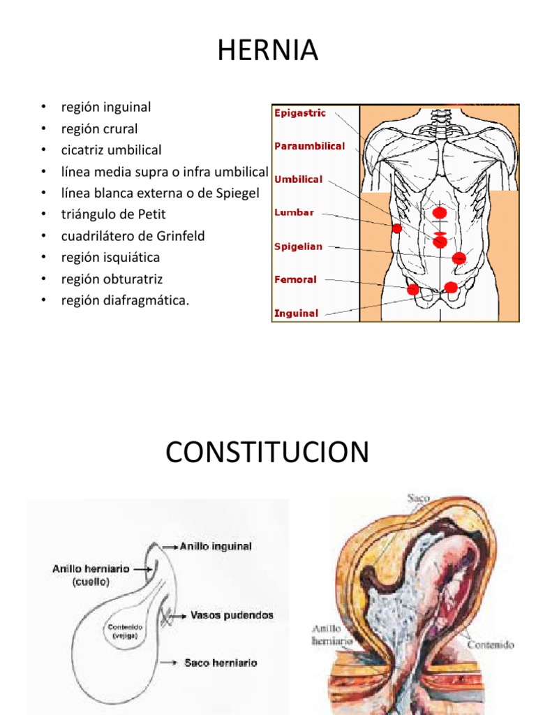 Hernias | PDF | Abdomen | Anatomía humana