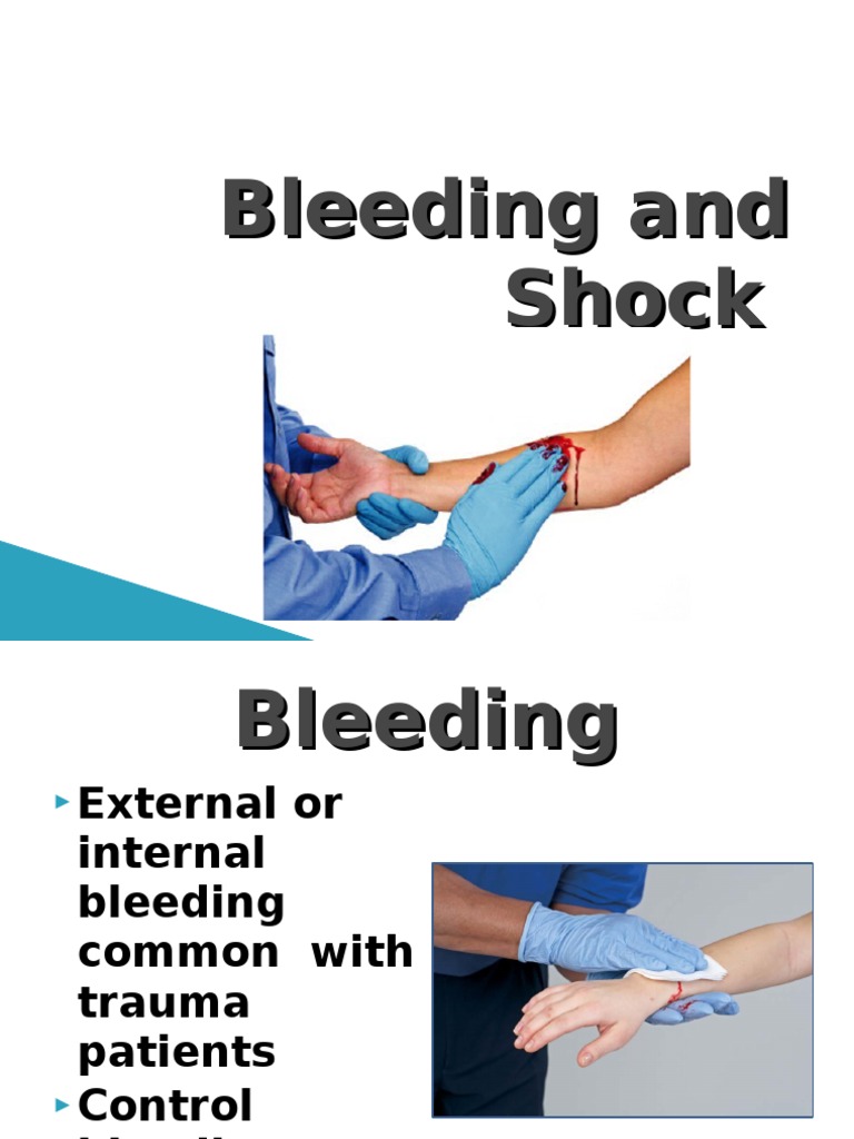 Shock Part 2 | PDF | Bleeding | Wound