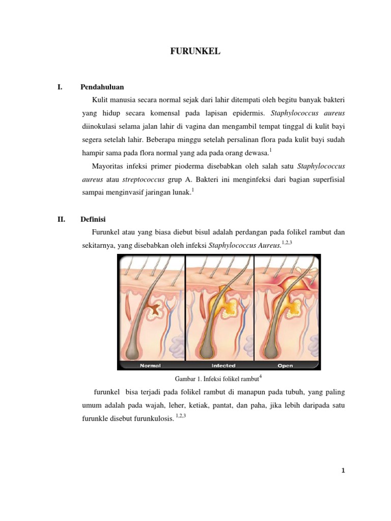 FURUNKEL (Kulit Baru) | PDF