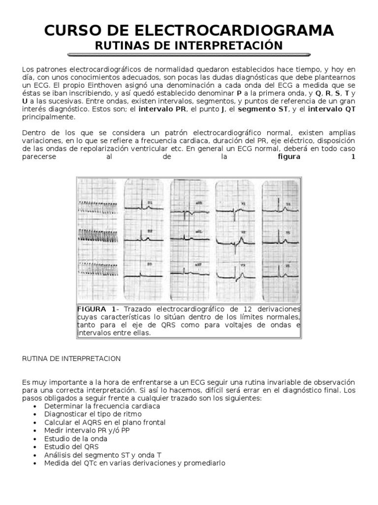 Guía completa para la interpretación sistemática de electrocardiogramas ...