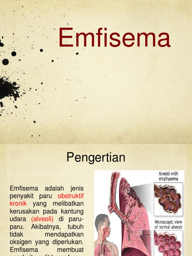 PPT Emfisema | PDF