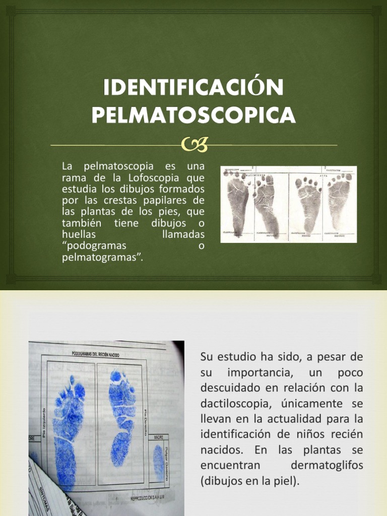 Pelmatoscopia Expo | Huella dactilar | Ciencia (general)
