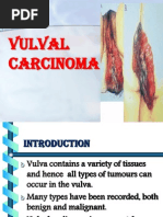 Mnemonic Vacum Forceps | PDF | Women's Health | Wellness
