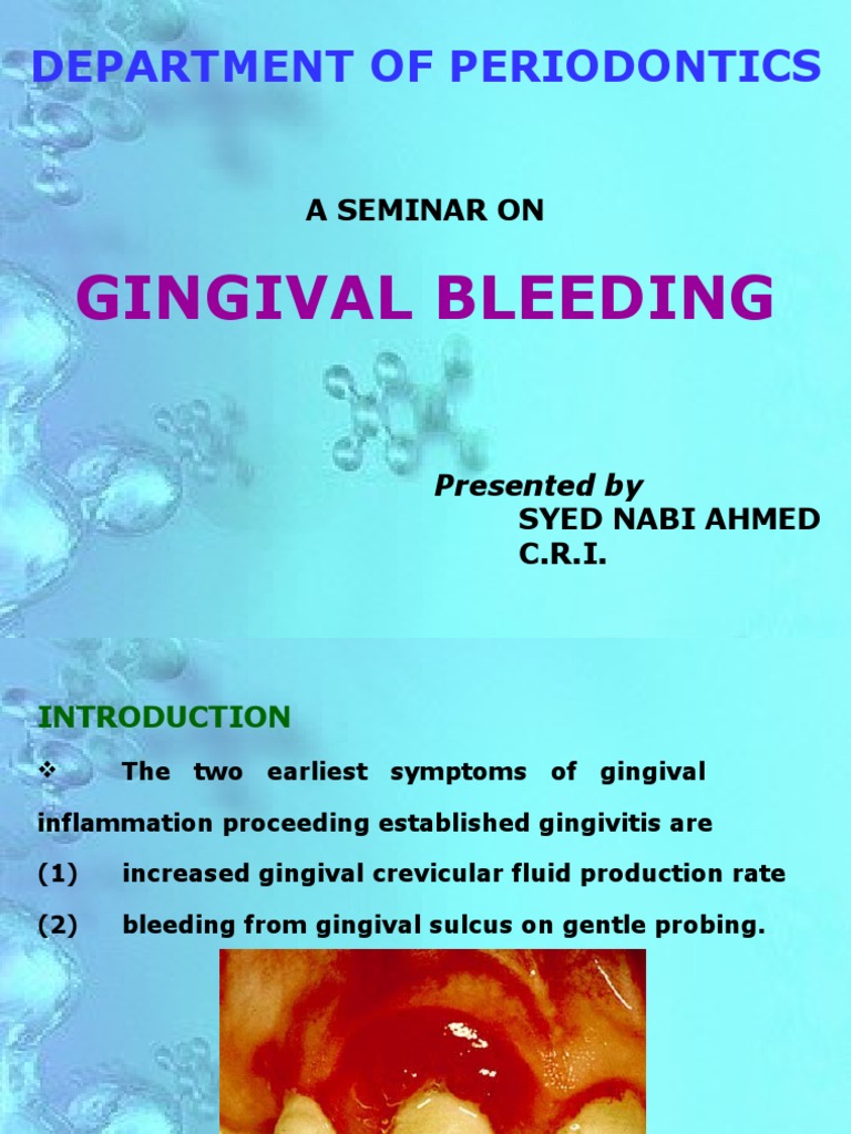 Gingival Bleeding | PDF | Periodontology | Medical Specialties