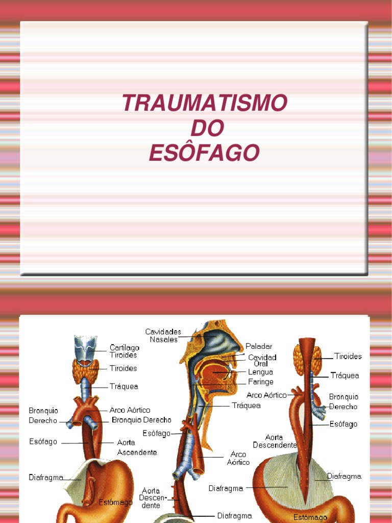 Trauma e Perfuração do Esôfago | PDF | Esôfago | Especialidades médicas