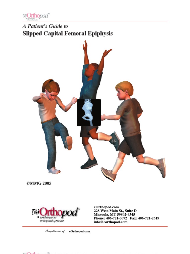 Slipped Capital Femoral Epiphysis | PDF | Osteoarthritis | Hip