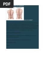 Test de Adams | PDF | Escoliosis | Especialidades Medicas