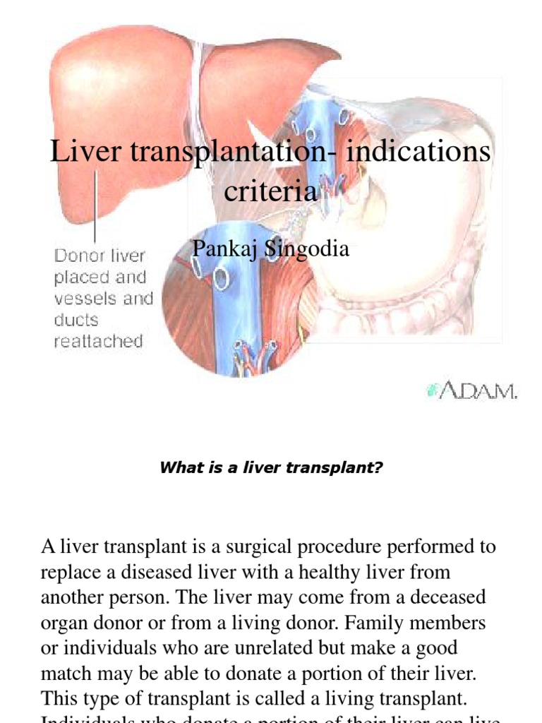 Liver Transplantation - Indications Criteria | PDF