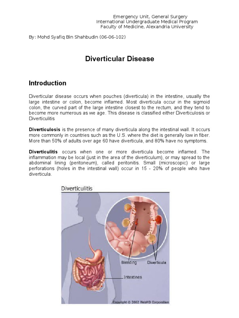 Diverticular Disease: Diverticulosis is the presence of many ...