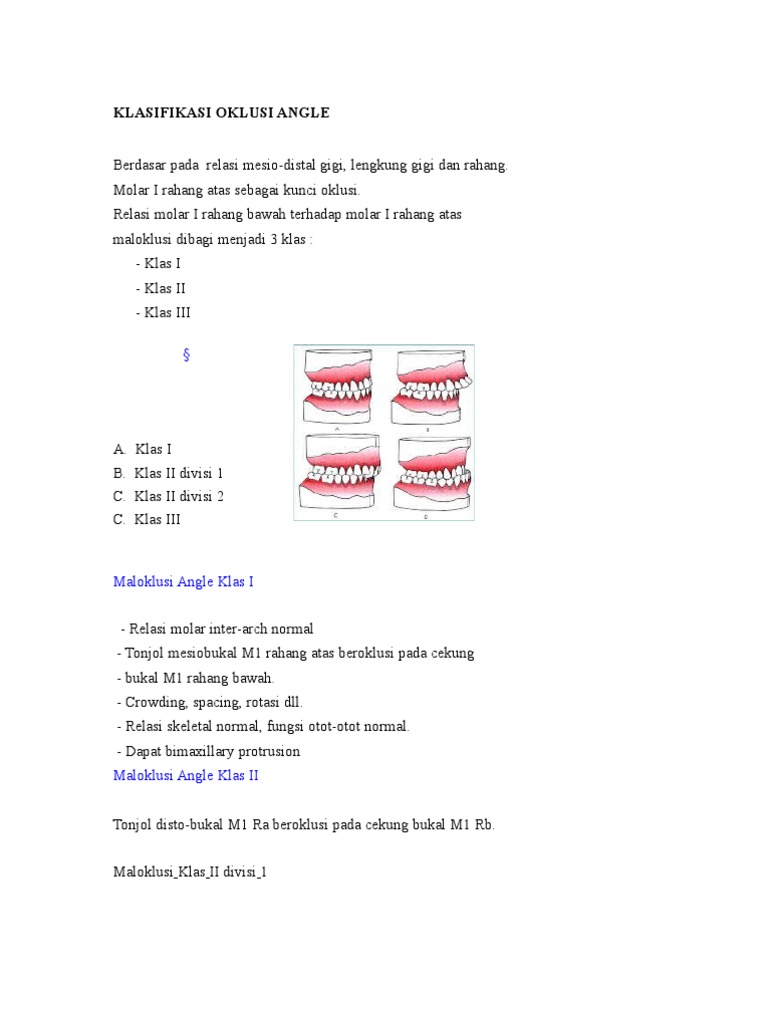 Klasifikasi Oklusi Angle: Klas I-III | PDF