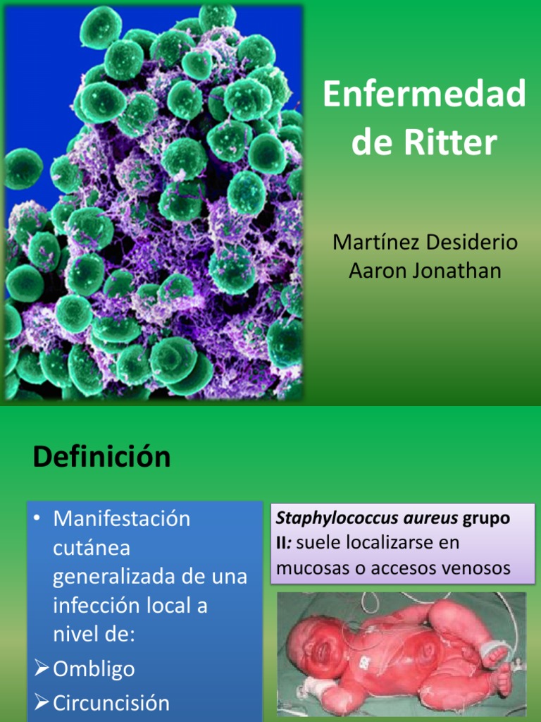Enfermedad de Ritter.pptx | Staphylococcus Aureus | Medicina
