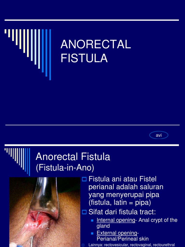 Fistula Ani | PDF | Sains & Matematika