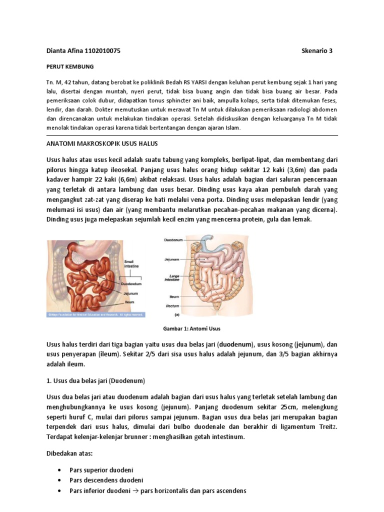 Ileus Obstruktif | PDF