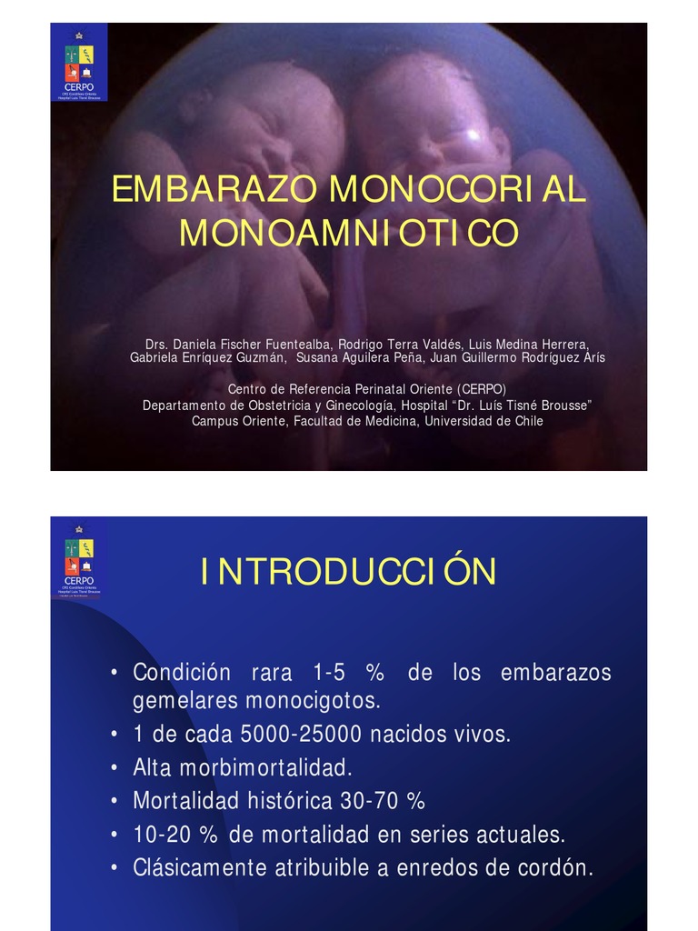 UChile Embarazo Monocorial Monoamniotico | PDF | Parto | Parto prematuro
