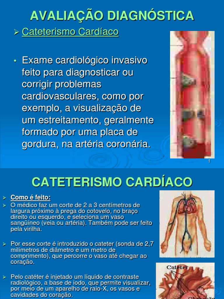 Aula 3 Disturbios Cardiacos | PDF | Angina Pectoris | Infarto do Miocárdio