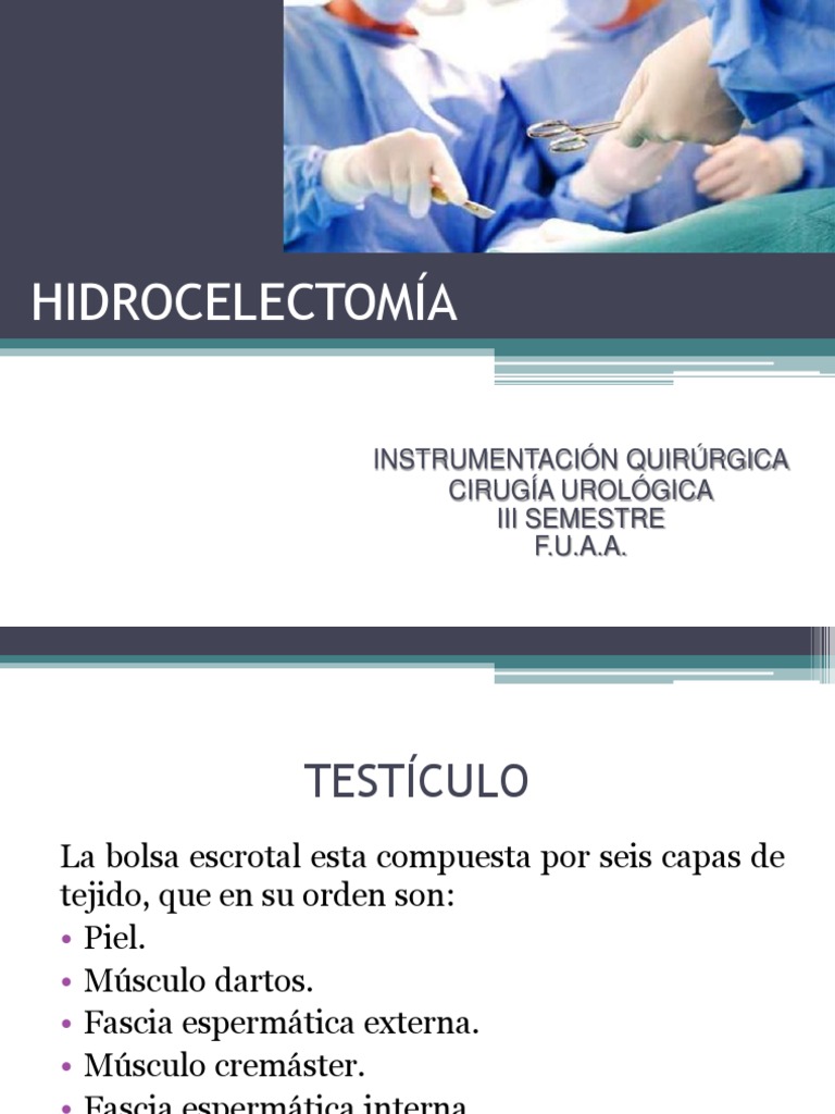 HIDROCELECTOMÍA