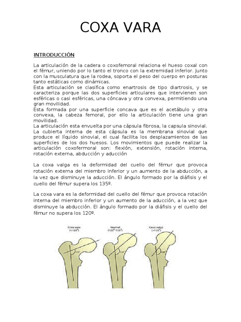 COXA VARA | Cadera | Sistema musculoesquelético