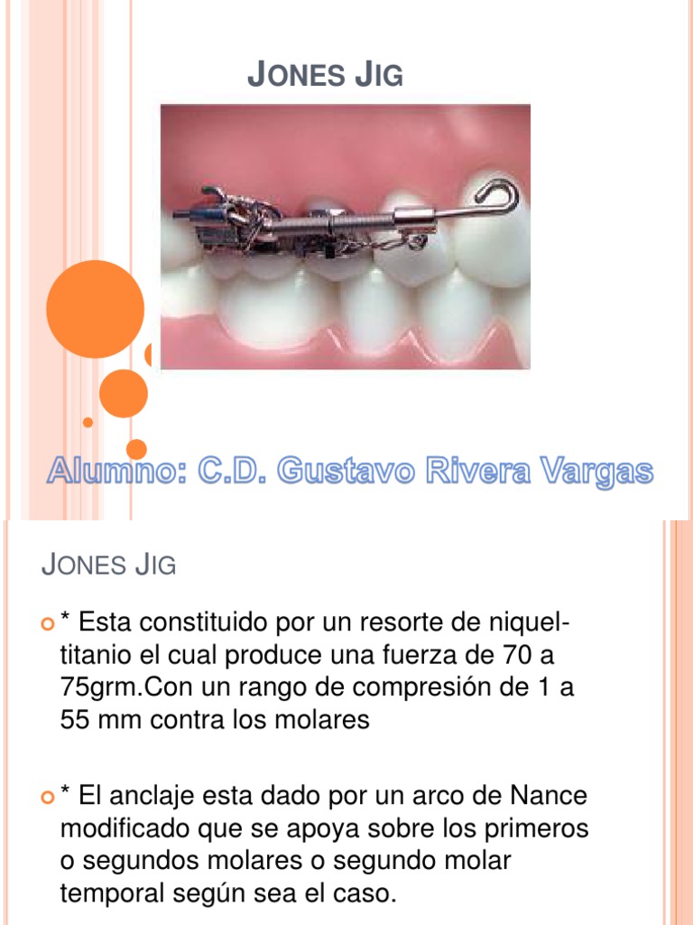 Jones Jig GRV | PDF