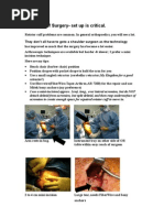 JuggerKnot™ Soft Anchor-2.9mm | PDF | Surgical Suture | Shoulder