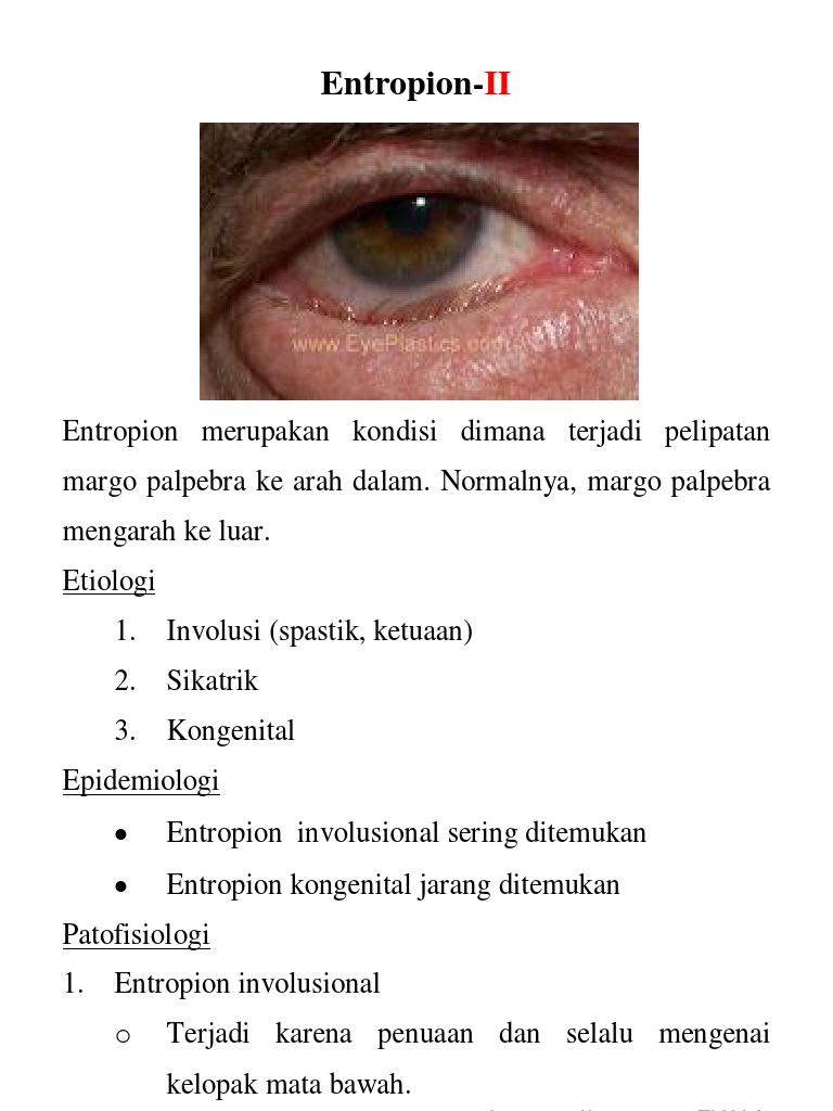 Entropion | PDF