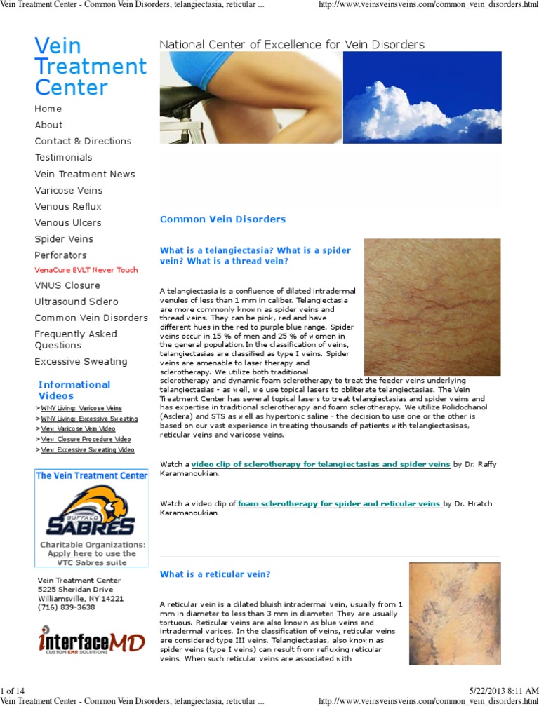 Vein Treatment Center - Common Vein Disorders, Telangiectasia ...