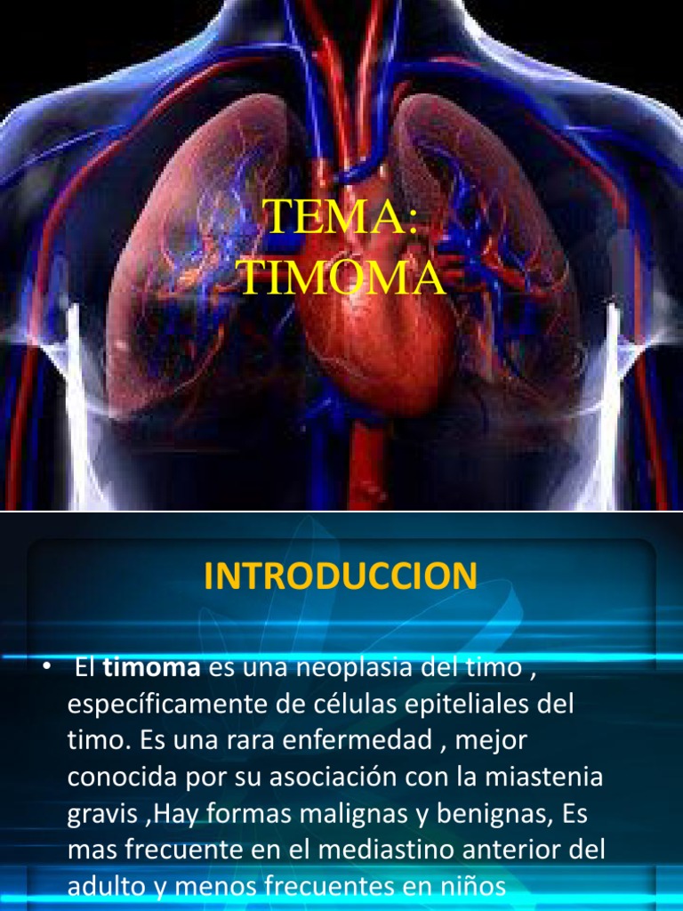 TIMOMA | Cáncer | Timo