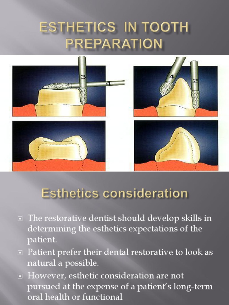 Esthetic Principles in Tooth Preparation | PDF | Dentistry Branches | Mouth