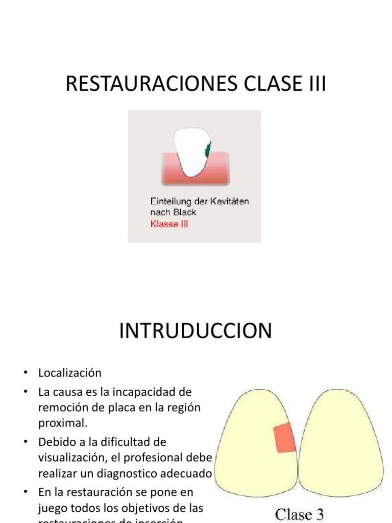 Restauraciones Clase III en Odontología | PDF