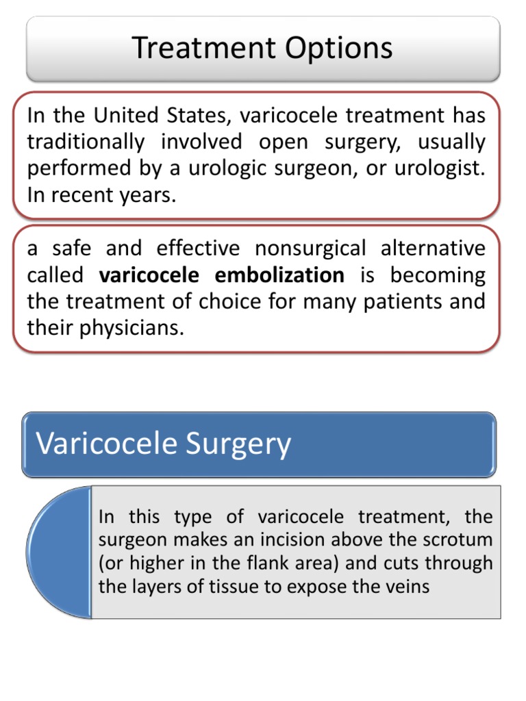 Varicocele | Surgery | Patient
