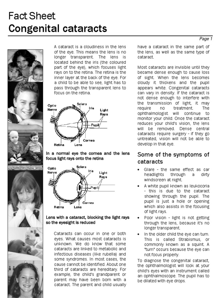 Fact Sheet Congenital Cataracts: Some of The Symptoms of Cataracts ...