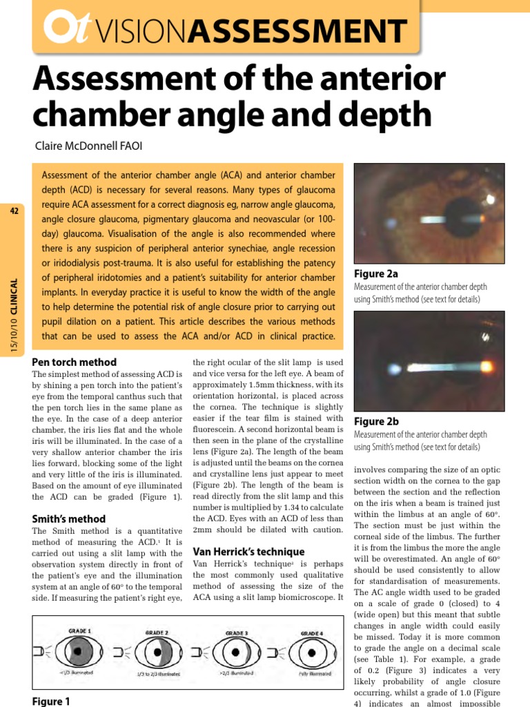 Smith Test, Goniolens, Shadow Test | Cornea | Glaucoma