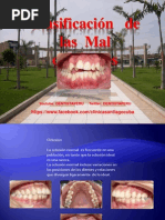 Clasificación Angle | PDF | Ortodoncia | Diente