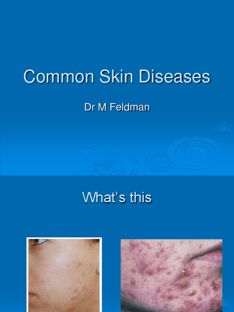 Common Skin Diseases | PDF