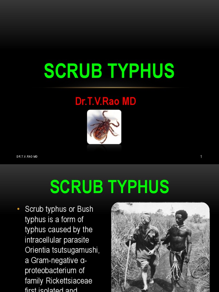 Scrub typhus. | Immunology | Microbiology