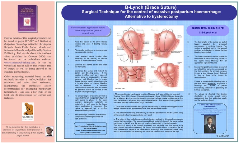 B Lynch PDF | PDF | Uterus | Surgical Suture