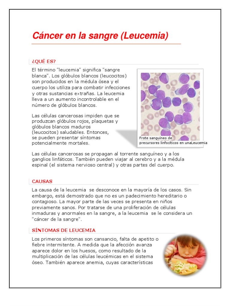 Tipos y Tratamientos de Leucemia | PDF | Leucemia | Leucocito